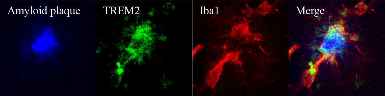 TREM2 Antibody [Unconjugated] (AF1729): Novus Biologicals