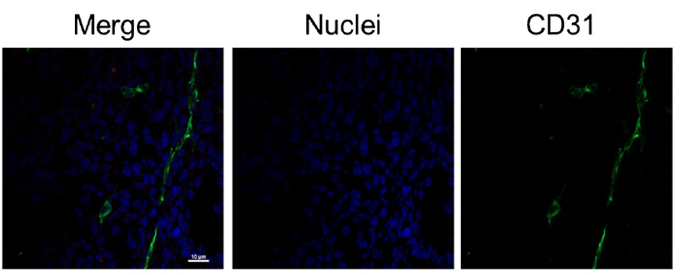 CD31/PECAM-1 Antibody (SP38) (NBP1-49805): Novus Biologicals
