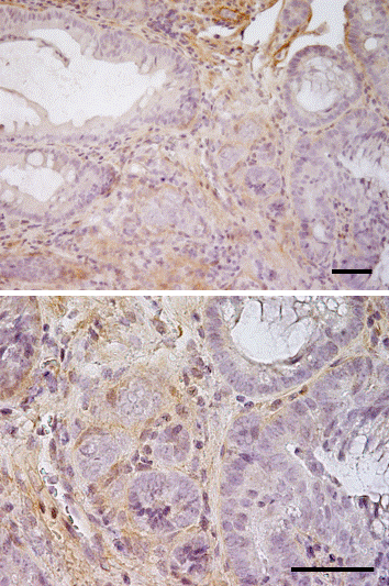 Glypican 3 Antibody (A7L6) (NBP1-97693): Novus Biologicals